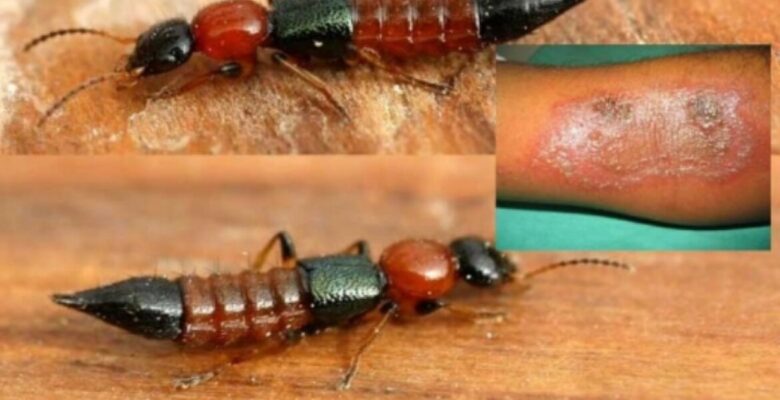 What are Nairobi flies that are inflicting ailment in Sikkim? - North ...